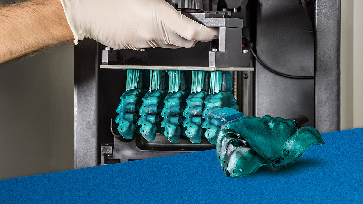 3D-Druck ohne eigene Investition: DentaMile übernimmt Design & 3D-Druck . DentaMile